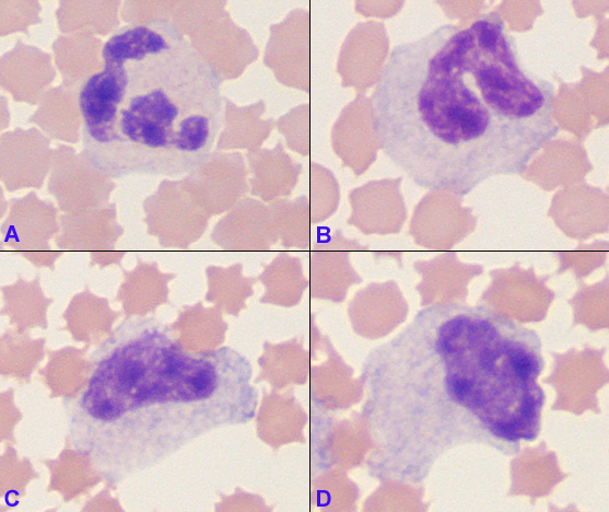 Research Laboratory: Neutrophils (polymorphonuclear leukocytes, PMNs ...