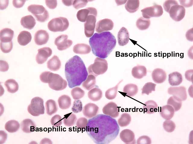 Sel Darah Merah Atau Lebih Dikenal Sebagai Eritrosit Memiliki Fungsi ...