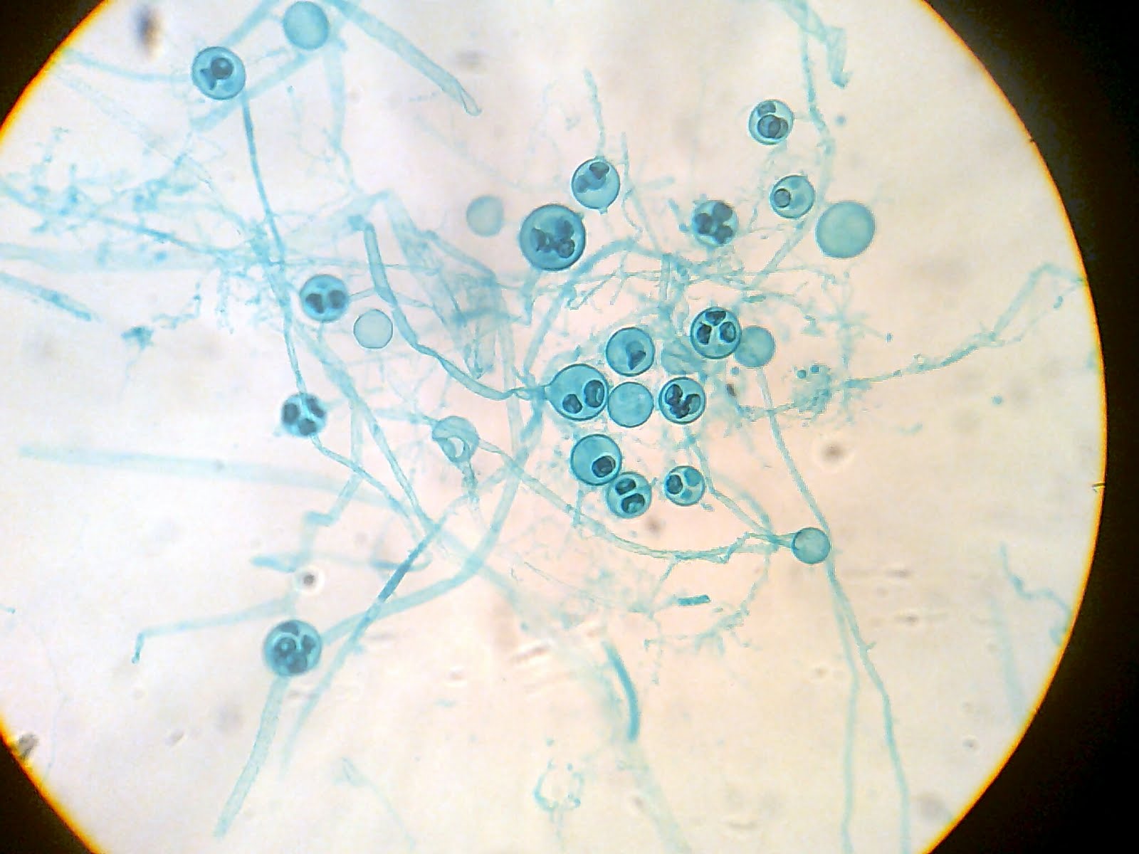Brizia Oria: Cariño por hongos...