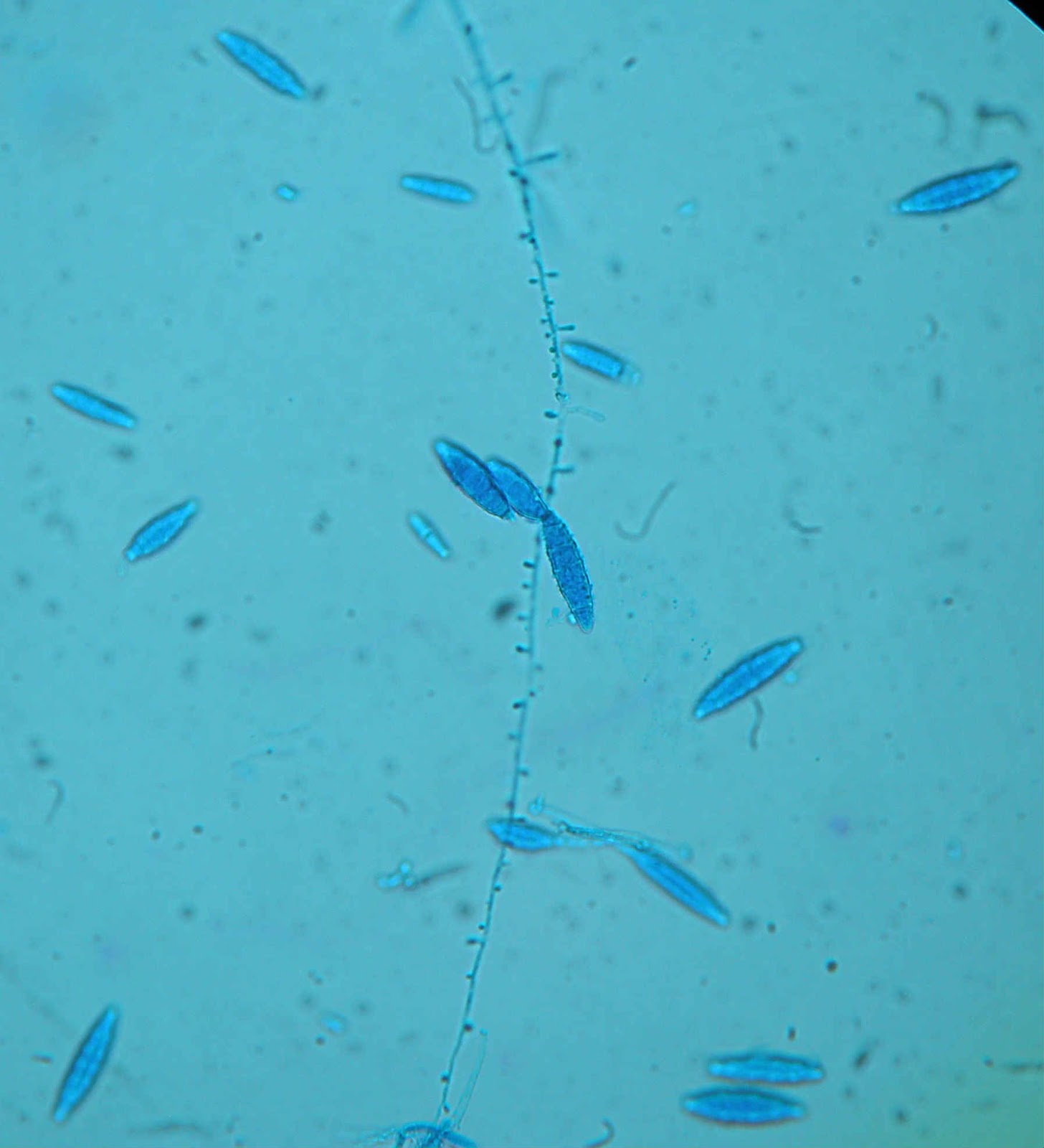 ATLAS MICOLOGIA: MICROSPORUM GYPSEUM