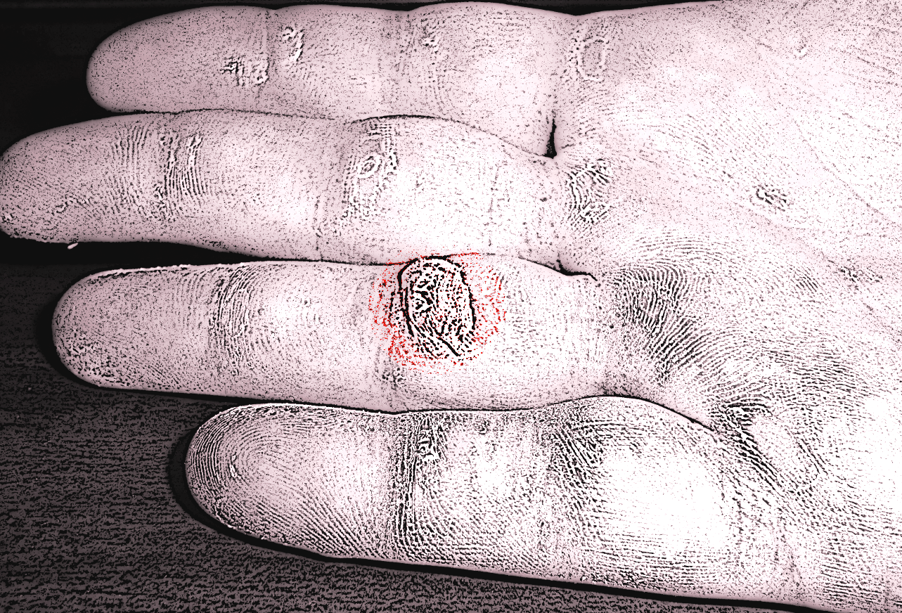 Vertical Progress: Und der Finger hat ein Loch ...