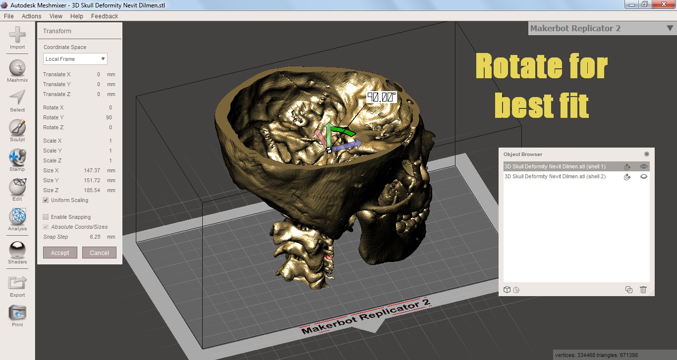 Nevit's blog: Using MeshMixer to cut and prepare a large medical model ...