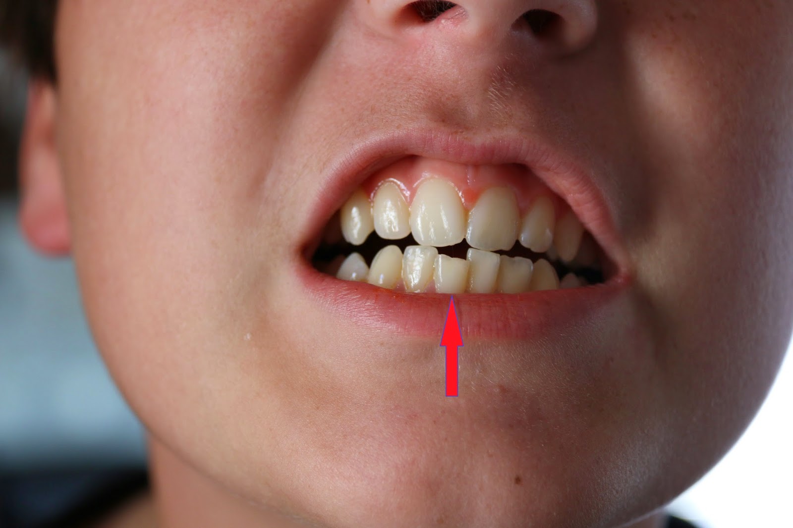 DIET COKE ROCKS: March 2014