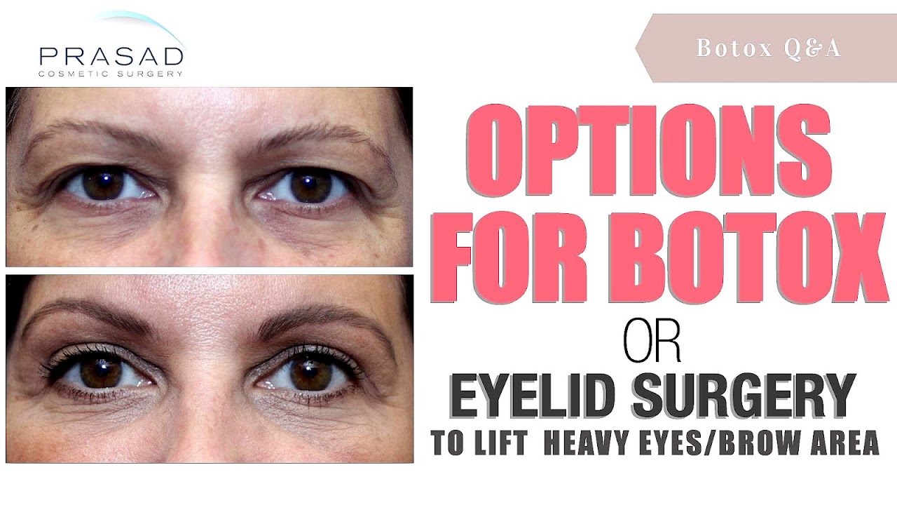Botox Eye Lift - Lift Choices