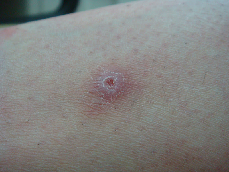 The "Secret" is Gratitude: Any Ideas as to What This Is? Missionary ...