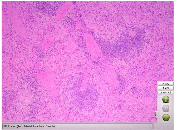 TP Histologie N° 2: la rate ~ TOP صحة