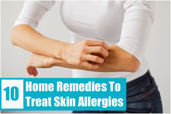 10 Effective Home Remedies To Treat Skin Allergies ~ Mzizi Mkavu