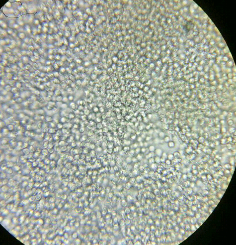 Blog do Daniel: leucócitos encontrados na urina