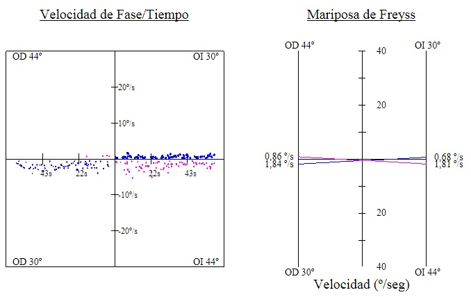 Neurociencias de la memoria y del equilibrio: ESTUDIO DE LAS ...
