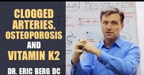 dr eric berg reviews: dr. berg's new body type guide