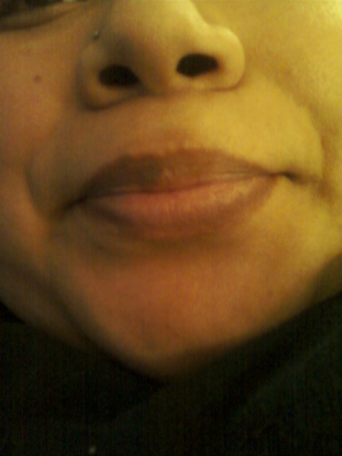 Living with Embouchure Dystonia: Embouchure Stretches / Lip Stretches ...