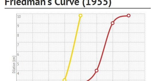 Lamaze Family Center: Friedman's Curve: An Outdated Standard?