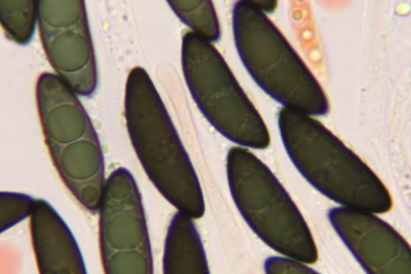 El mundo microscópico de los hongos: Xylaria polymorpha (Pers.) Grev.