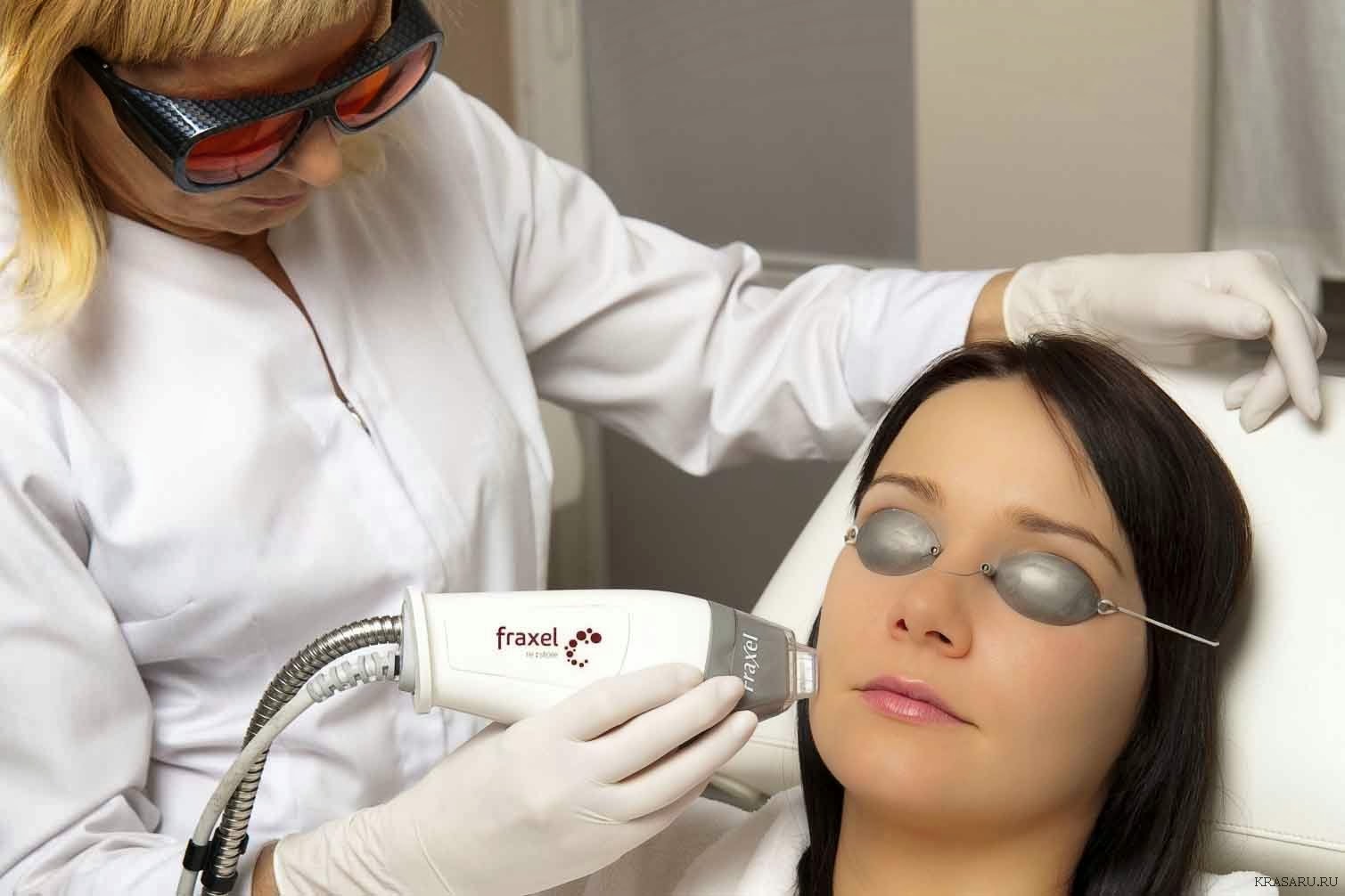 THE FACE Laser Clinic: Procedures in THE FACE Laser Clinic
