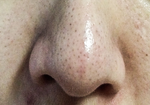 CARA AMPUH MENGHILANGKAN KOMEDO SECARA ALAMI ~ anief home