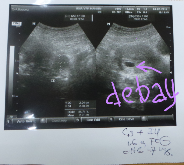 Trimester 1: Konsul Obgyn Pertama (6-7 Weeks) ~ Griya Jeng Menik & Mas Poer