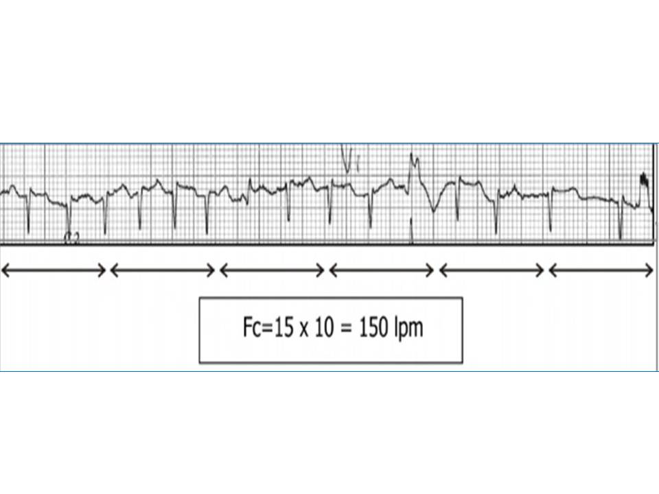 Emergencias Cardiovasculares