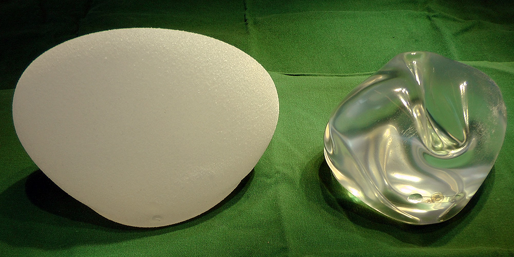 Victoriakliniken: Varför ska man välja formstabila implantat?