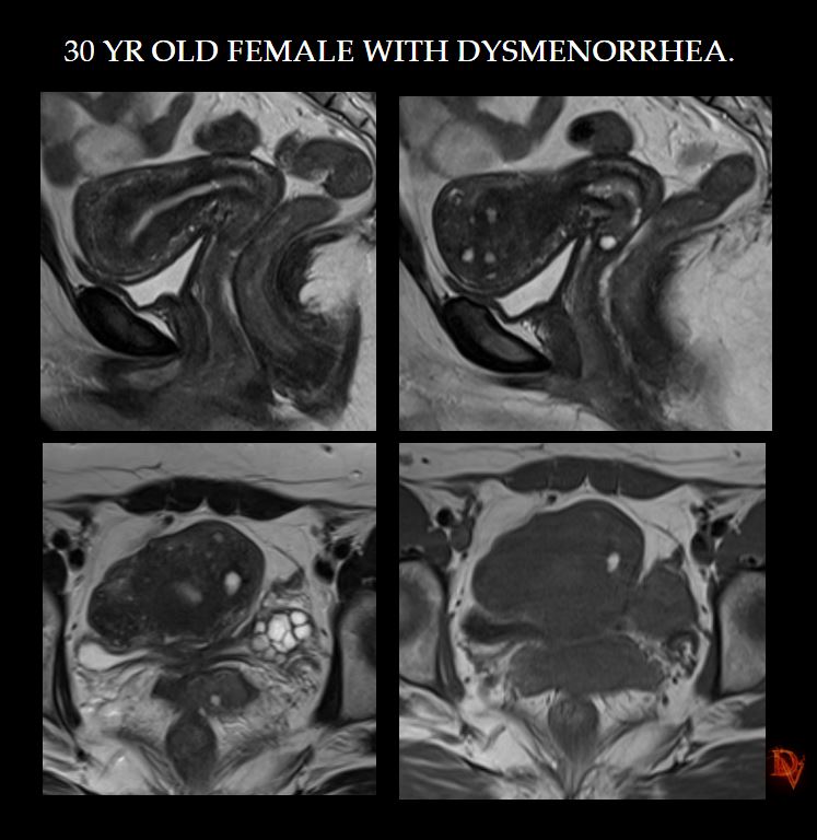Ultimate Radiology : April 2016