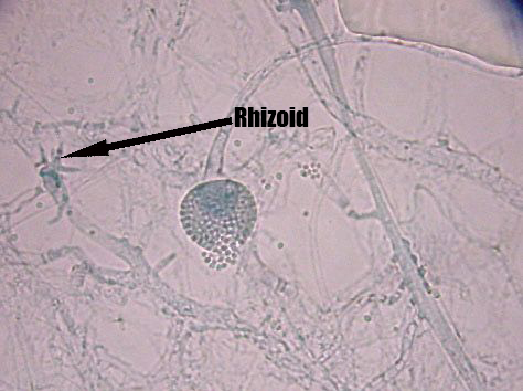 Fungal Structures and Mycology Terminologies Essential for ...