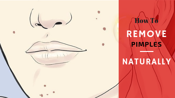 How To Remove Pimples Naturally