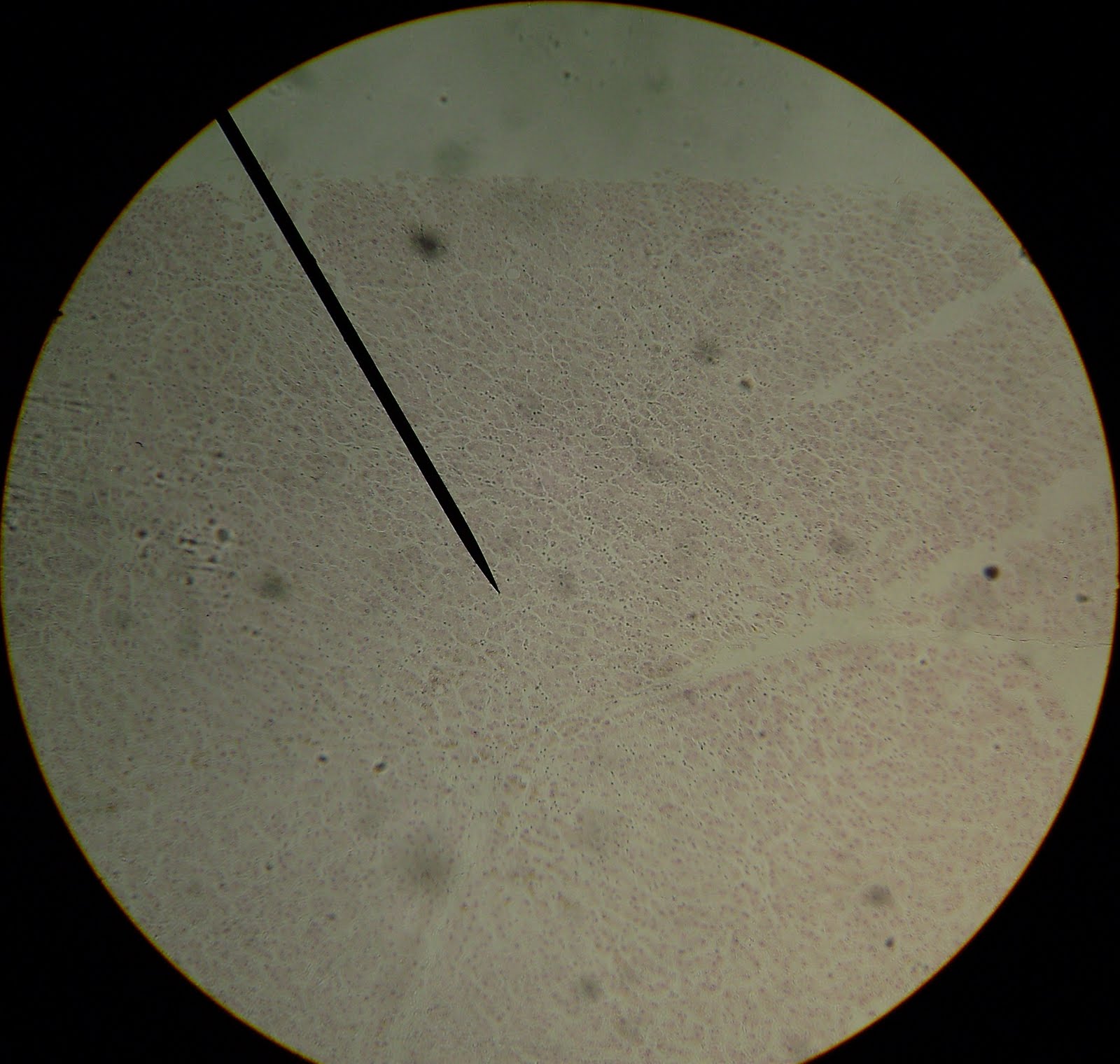 Anatomy and Physiology 2 Eportfolio: Objective 59:And some People Eat ...