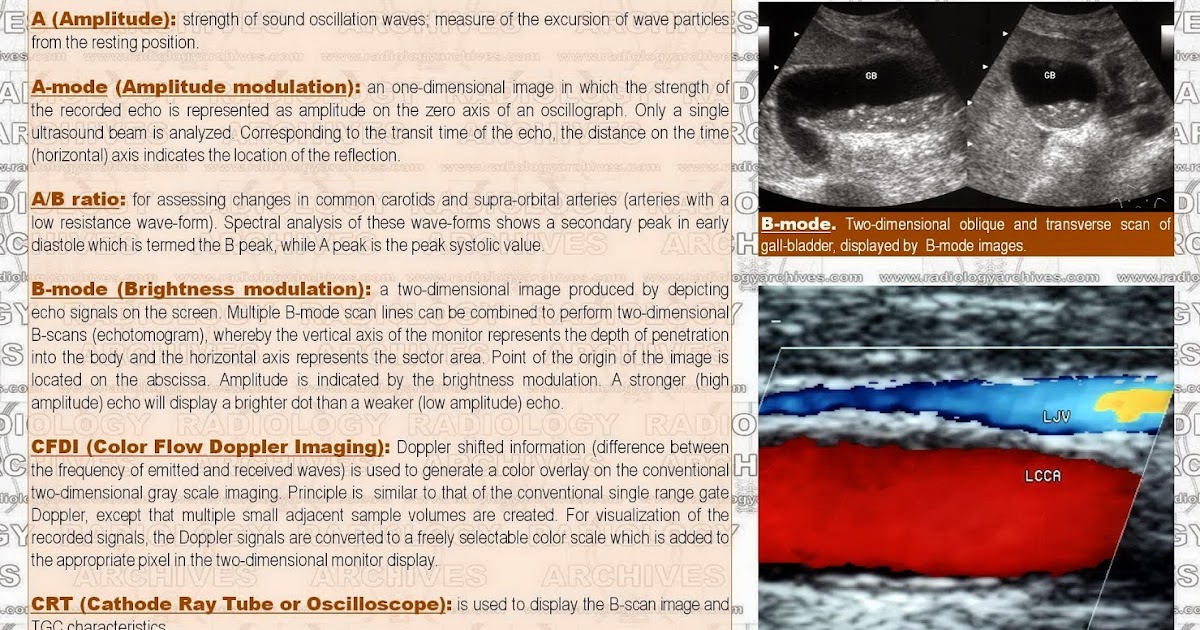 Radiology Archives: An Ultrasound Terms Lexicon Illustradted for ...