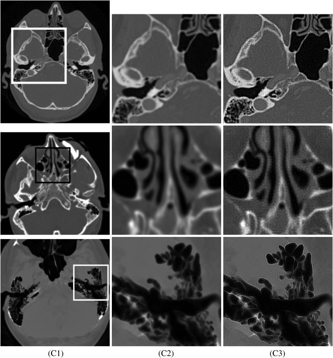 Digital Image Restoration: Medical image restoration