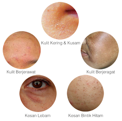 SURIKU KOLAGEN DIHATIKU