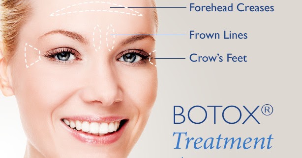 Botox, Acido Hialurónico, Bichectomia, Invisible Touch Hilos Pdo