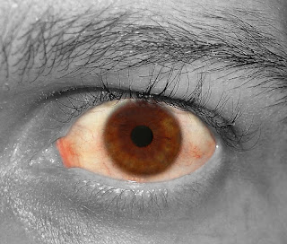 CANNABIS Y OJOS ROJOS | Óptica Alomar Barcelona