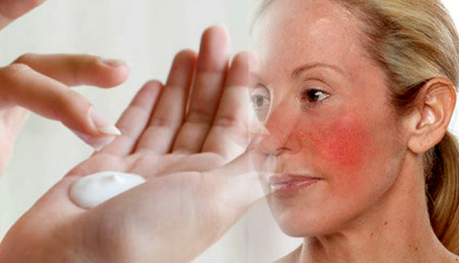 Ciri-Ciri Iritasi Kulit Karena Kosmetik dan Cara Mengatasinya - Tips ...