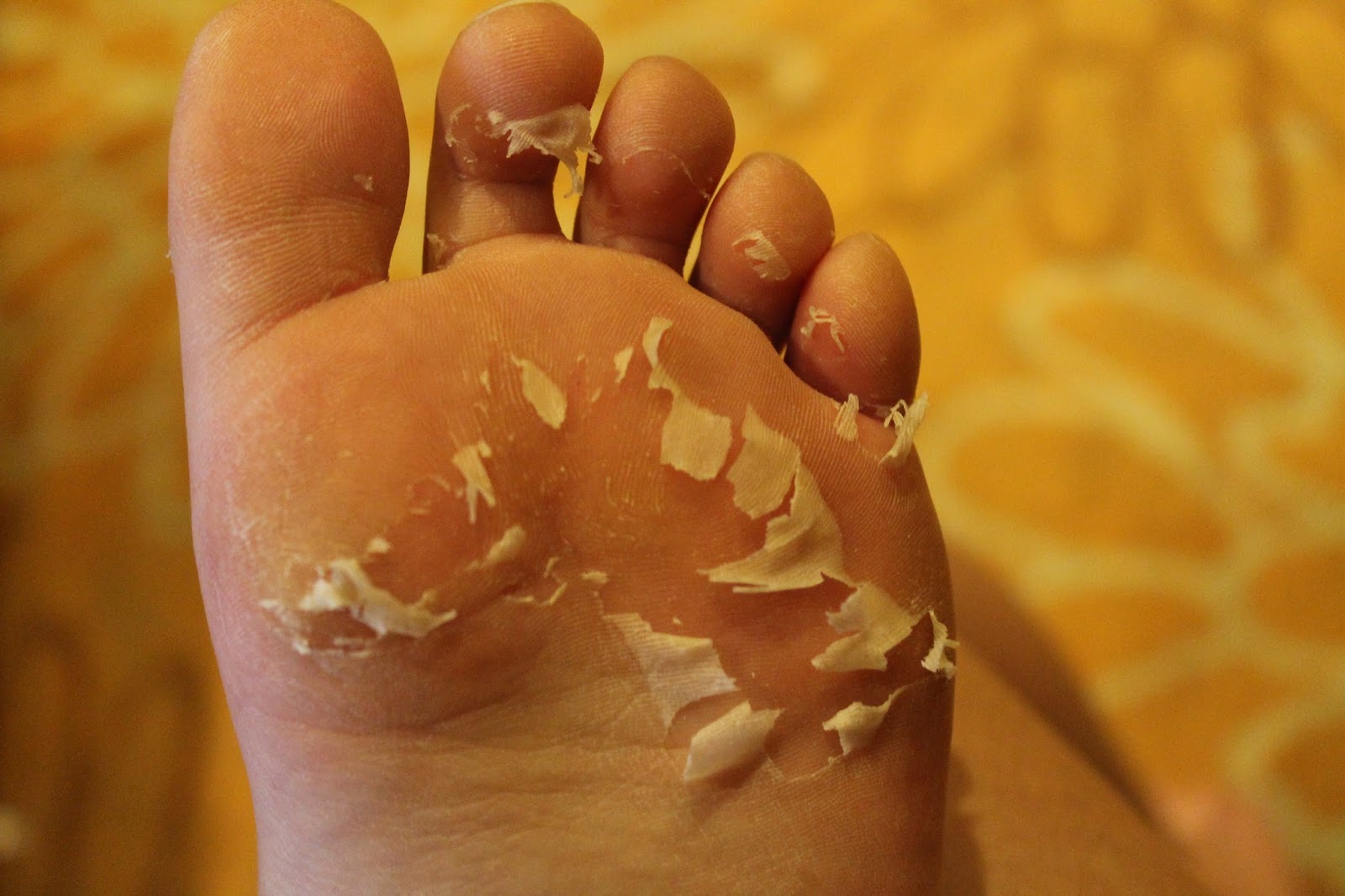 Wiktoria Gajewska: Magic Foot Peel - zadbane stopy