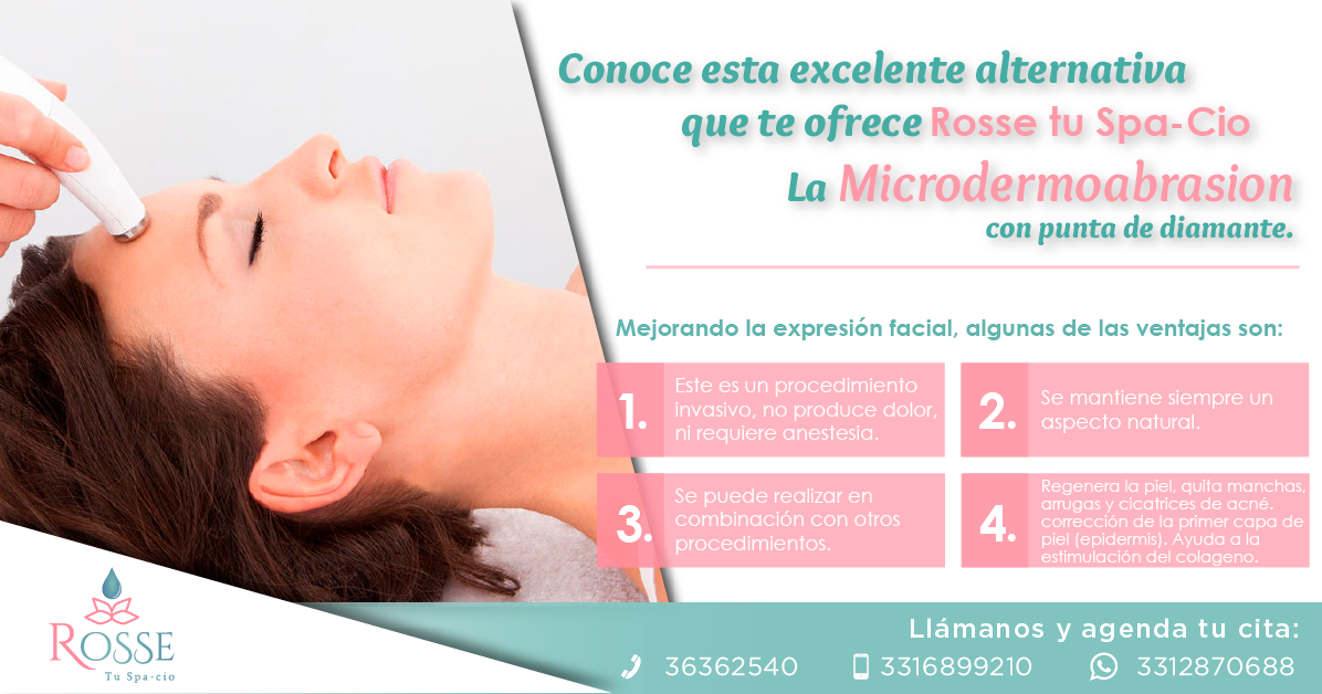 Rosse tu Spa-Cio. : Conoce los beneficios de la Microdermoabrasion.