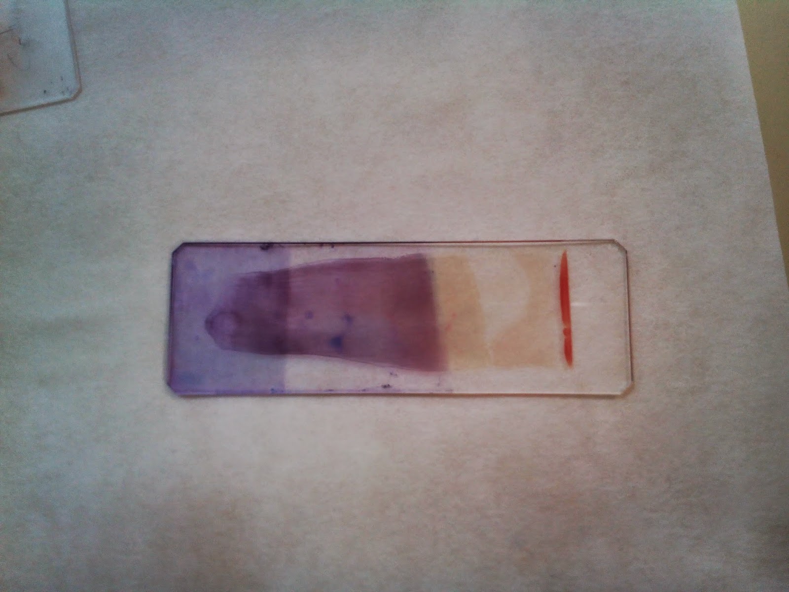 Bienvenidos a LDC: Tinción de Giemsa