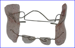 APARATOLOGIA ORTOPEDICA: FRANKEL IB