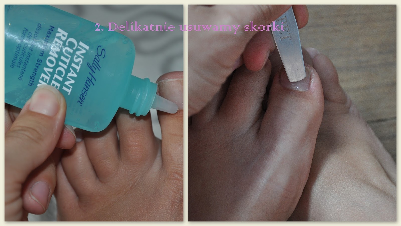 Hybryda na stopach - krok po kroku