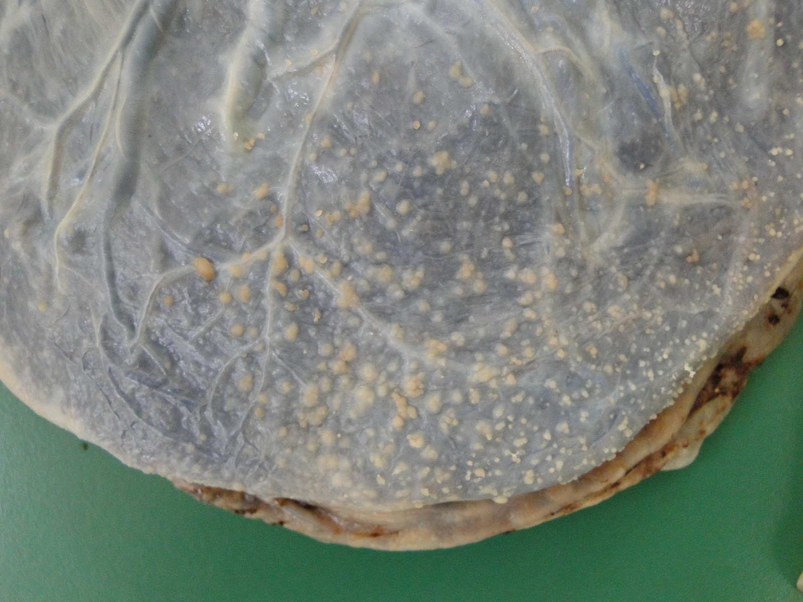 Histopatologando - Atlas do HCFMRP-USP: Âmnio nodoso