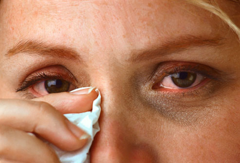 Burning Eyes – Causes of Burning Eyes ~ Living Healthy Life