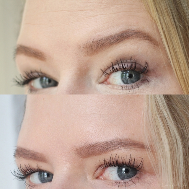 ♥ In Love With Life ♥: Stirnfalten adé..!? Meine Botox-Erfahrung | Teil ...