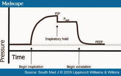 Respiratory Therapy Cave: Ventilator Pressures: Static -vs- Plateau