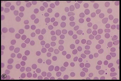 FICHERO DE HEMATOLOGIA: Eritropoyesis