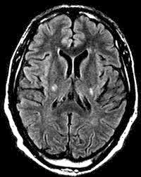 Medical Treatment Pictures-for Better Understanding: Primary Lateral ...