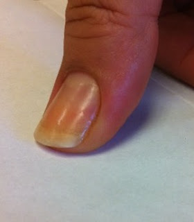 Bling it ON!: Tea bag patch!