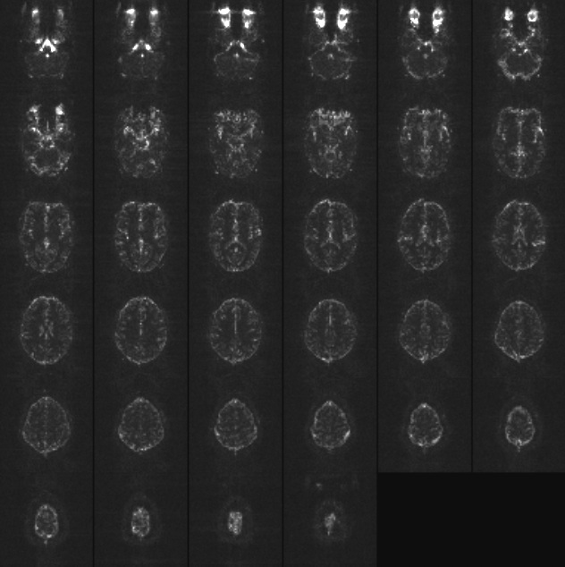 practiCal fMRI: the nuts & bolts: Understanding fMRI artifacts: "Good ...