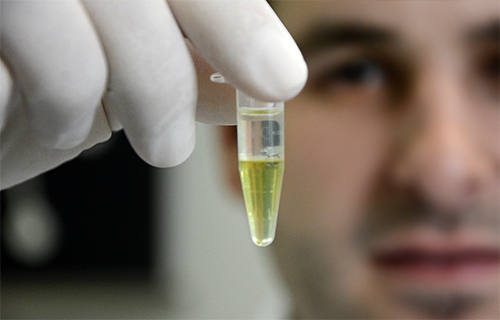 Prinsip, Metode, dan Teknik Isolasi DNA - Generasi Biologi