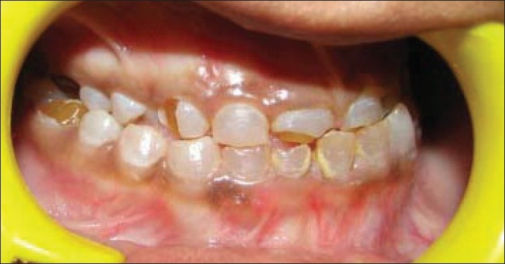 Embriología Bucodental: Biopatologías y consideraciones clínicas de la ...
