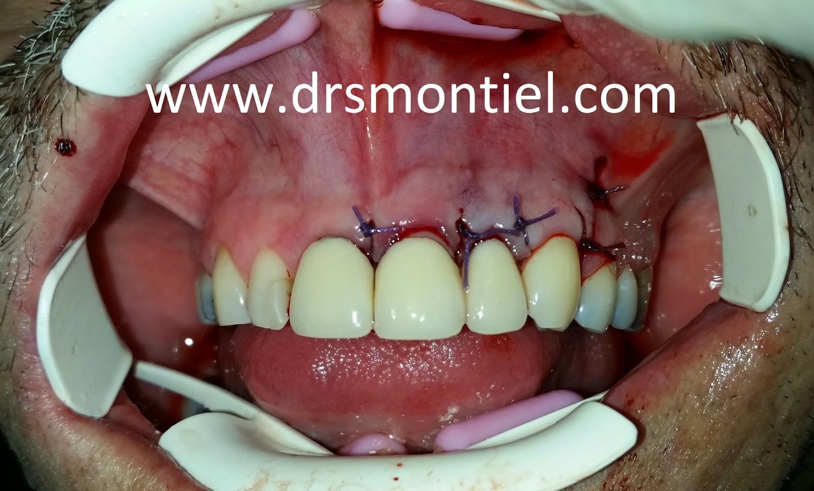 Cirujano Oral, Estética y Armonización