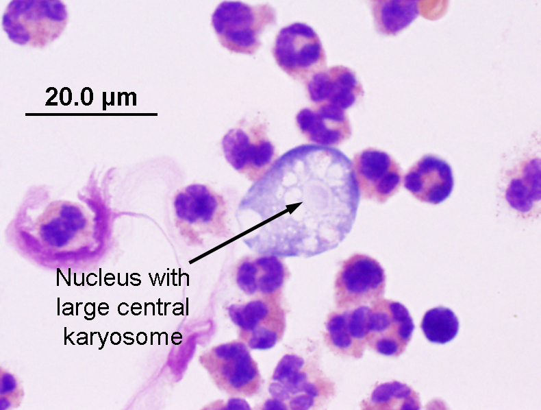 Creepy Dreadful Wonderful Parasites: Answer to Case 229