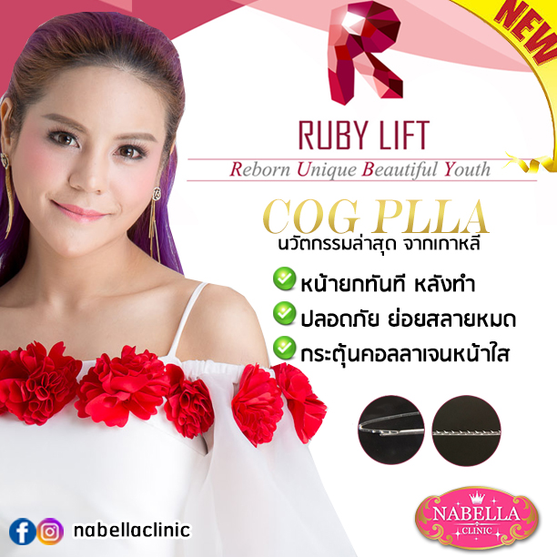 NaBella Clinic By NaBell: ร้อยไหมRuby Lift Cog PLLA คืออะไร???หน้ายกทันทีหลังทำ!!!นาเบลแนะนำค่ะ